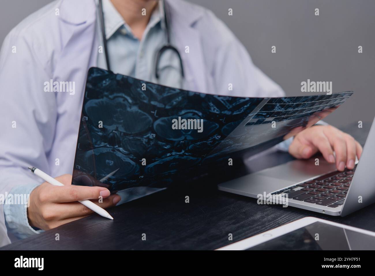 Doctor reviewing an MRI brain scan with a laptop on the desk, focusing ...