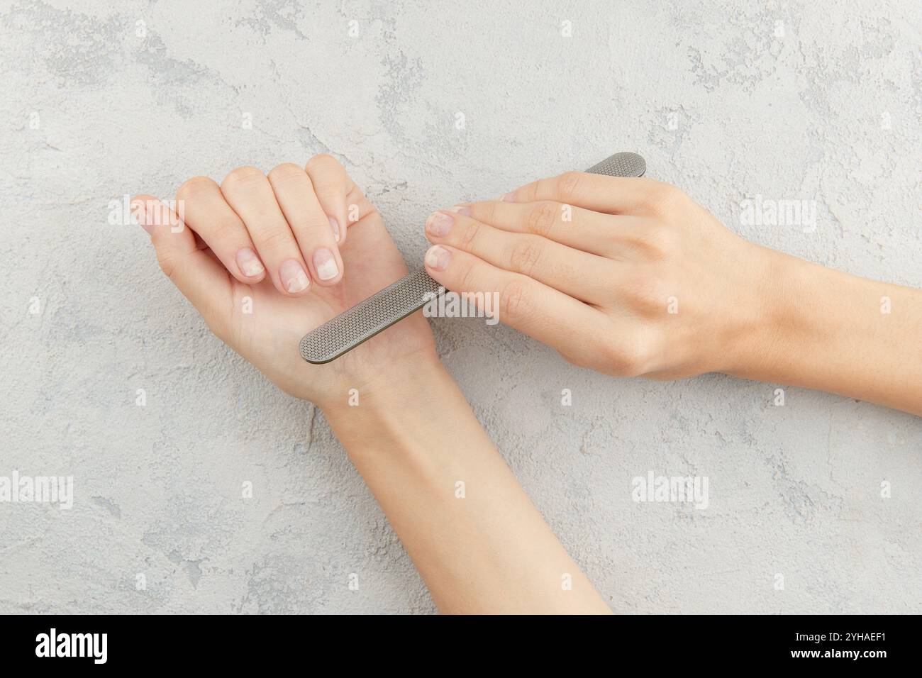 Woman filing damaged nails. Fingernails with onycholysis after removing ...