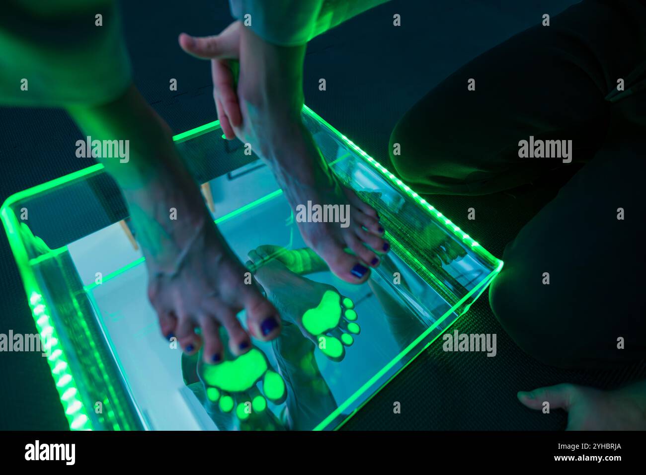 Pedobarography analysis shows the distribution of plantar pressure of ...
