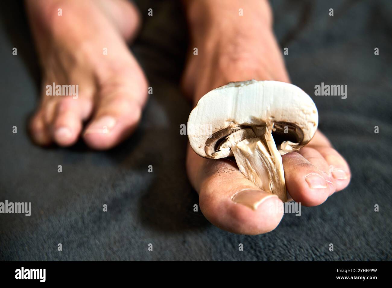 Bavaria, Germany - November 11, 2024: Fungus and a foot. Symbolic image ...