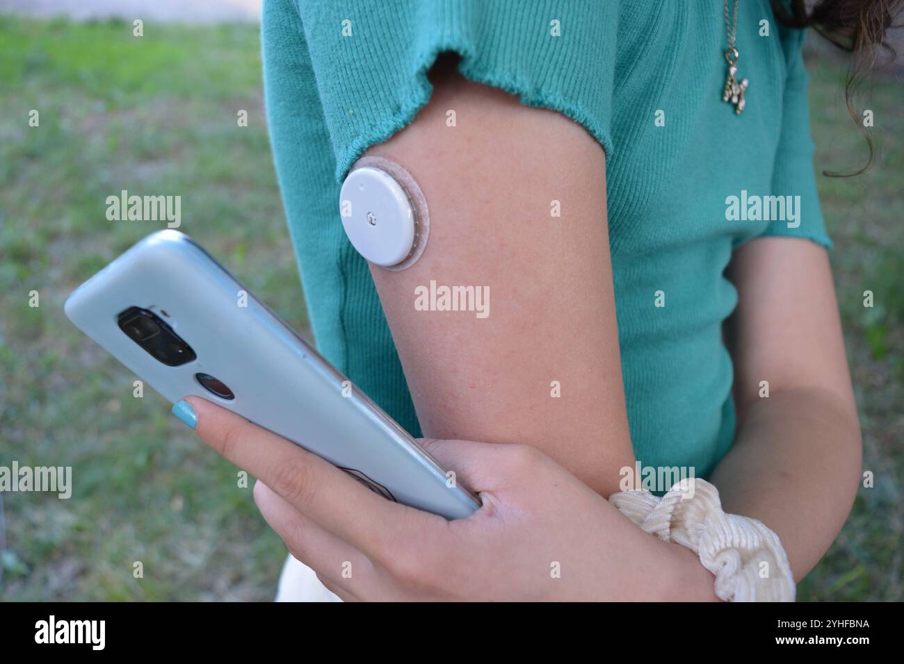 Girl with diabetes is reading the glucose levels from a white sensor on ...