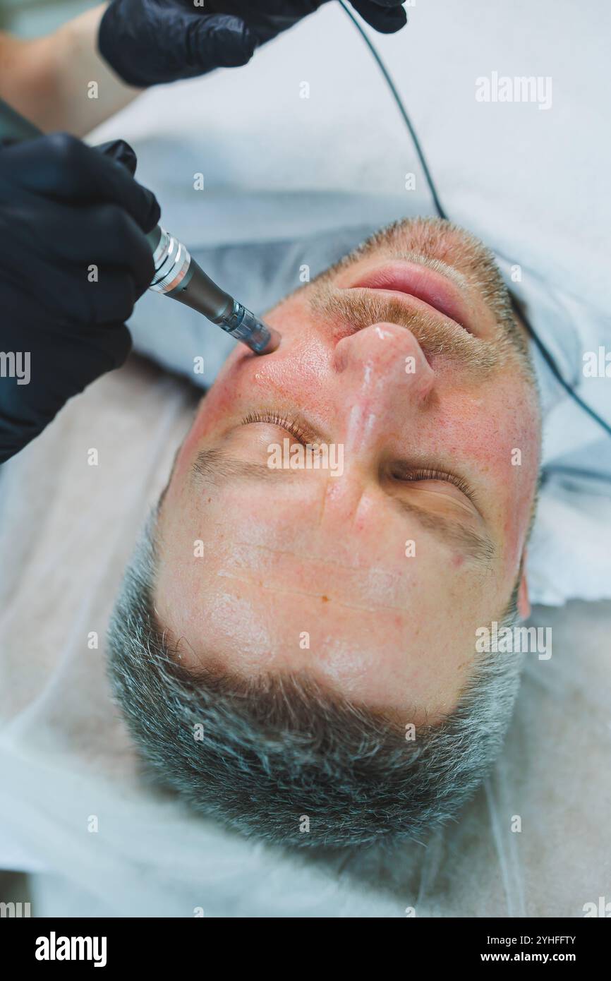 Male cosmetology in a beauty salon. A man takes care of his facial skin ...