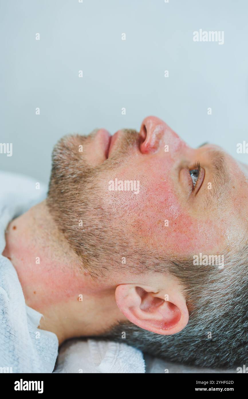 Male cosmetology. A man lies at a cosmetologist for a facial treatment ...