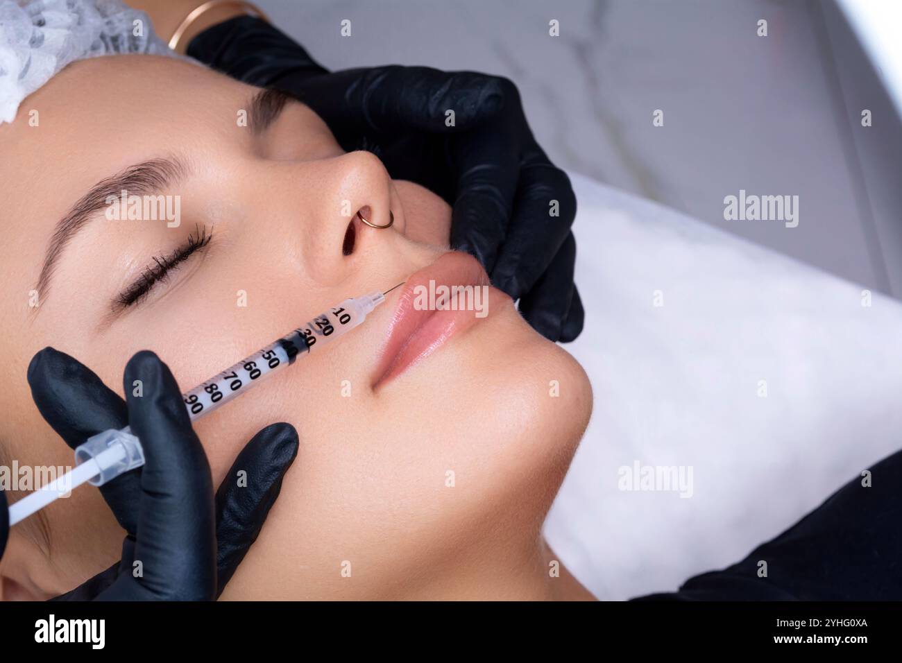 A beautician performs a lip augmentation procedure with hyaluronic acid ...