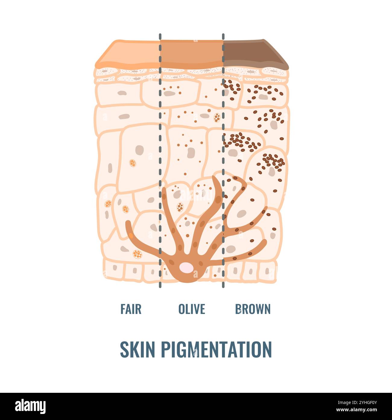 Pigmentation process hi-res stock photography and images - Alamy