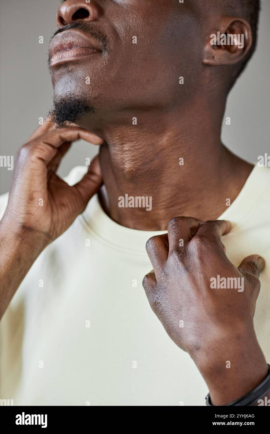 Eczema african hi-res stock photography and images - Alamy