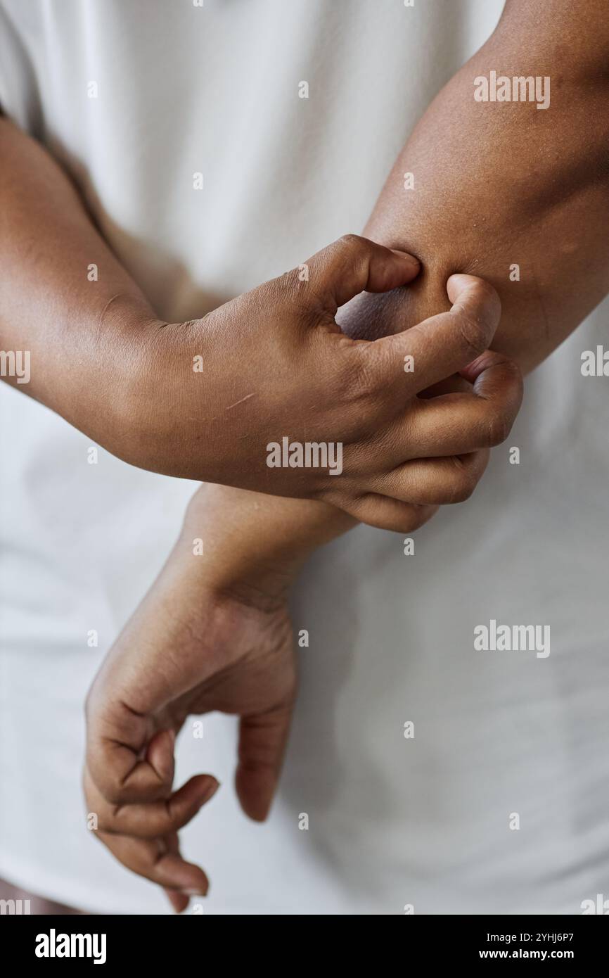 Vertical close up of African American woman scratching hands and arms ...
