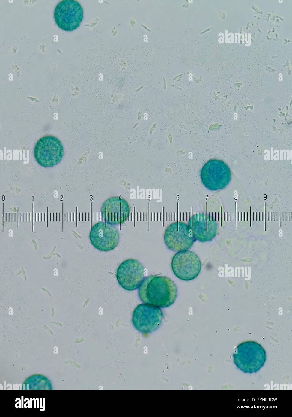 Trichia crateriformis hi-res stock photography and images - Alamy