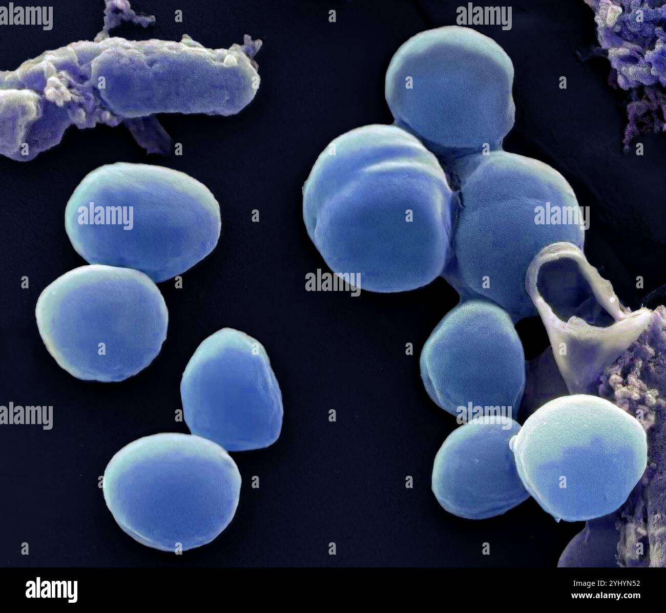Chlamydia. Coloured scanning electron micrograph (SEM) of a colony of ...