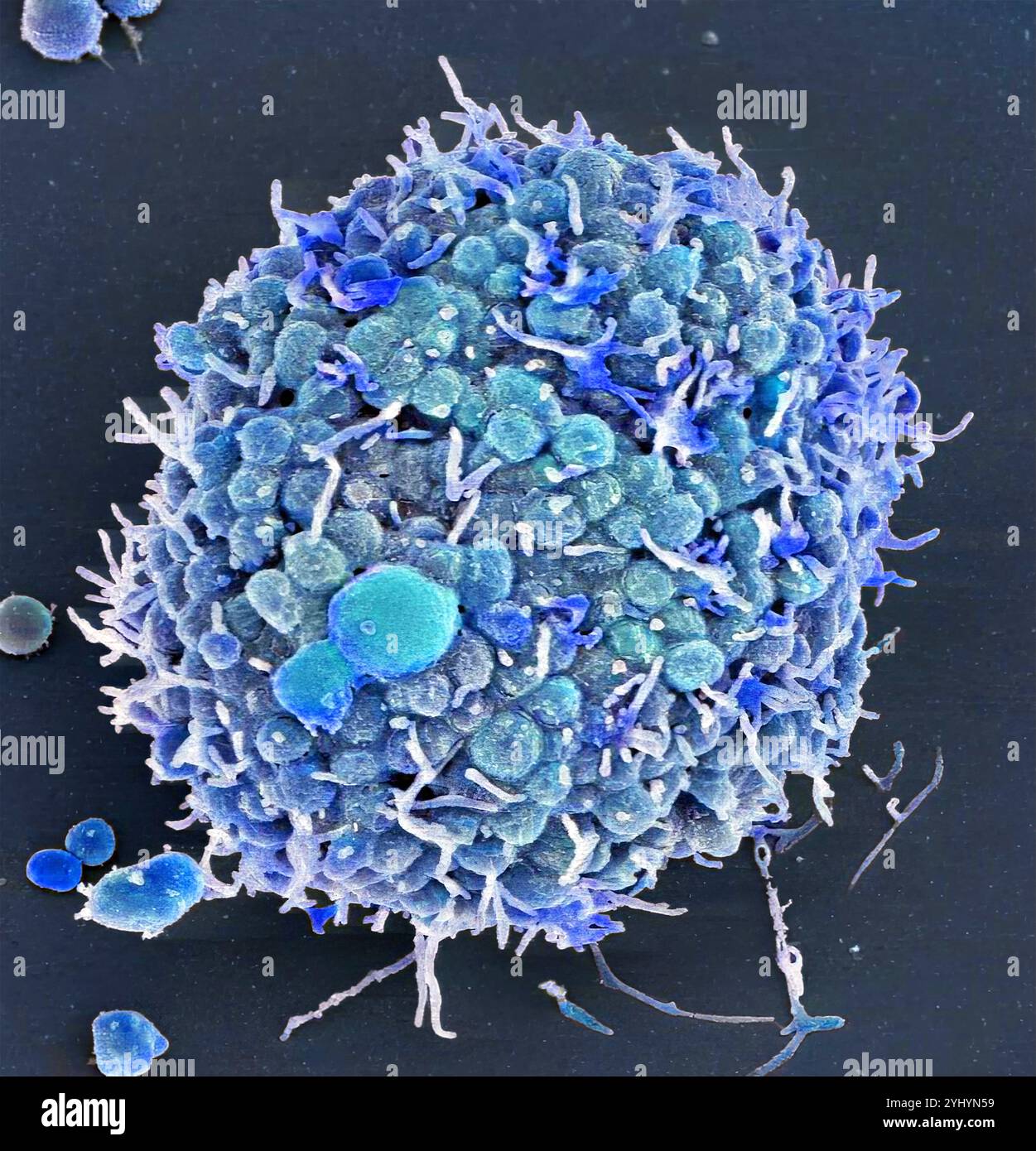 Activated mast cell, SEM Stock Photo - Alamy
