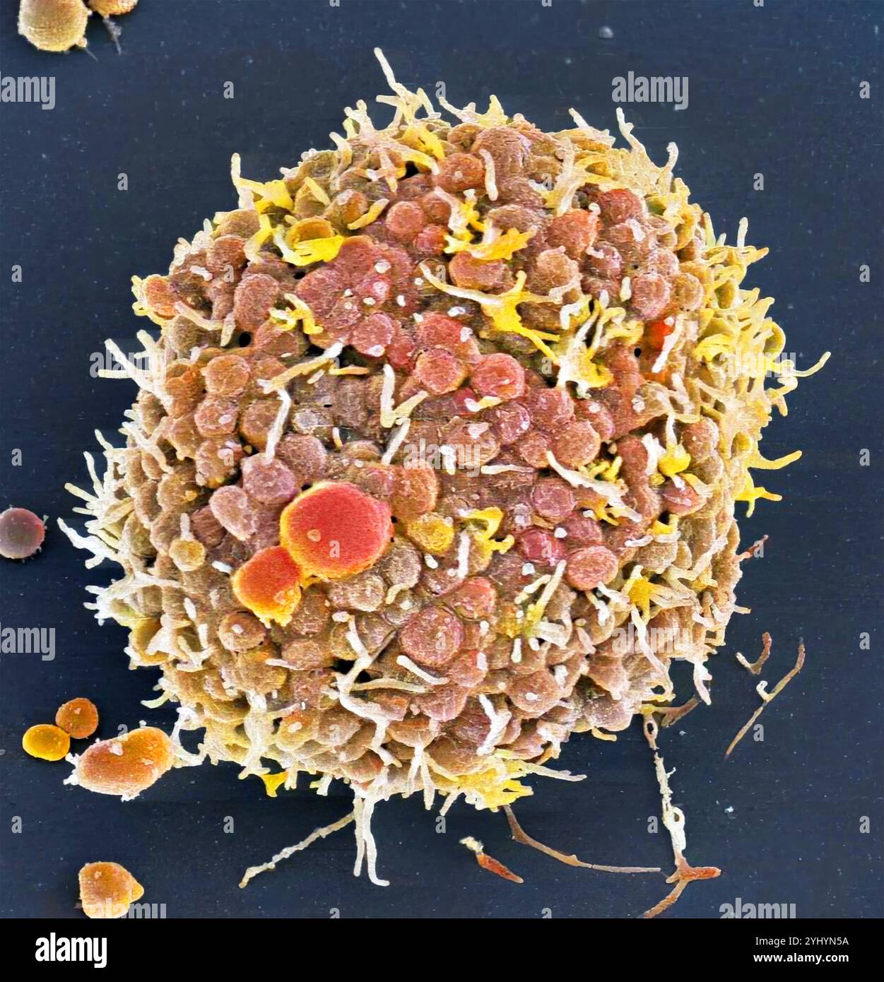 Activated mast cell, SEM Stock Photo - Alamy