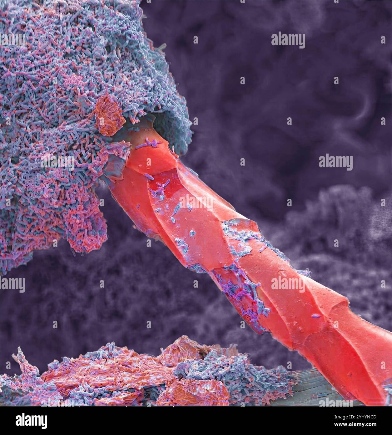 Shower waste biofilm. Coloured scanning electron micrograph (SEM) of ...