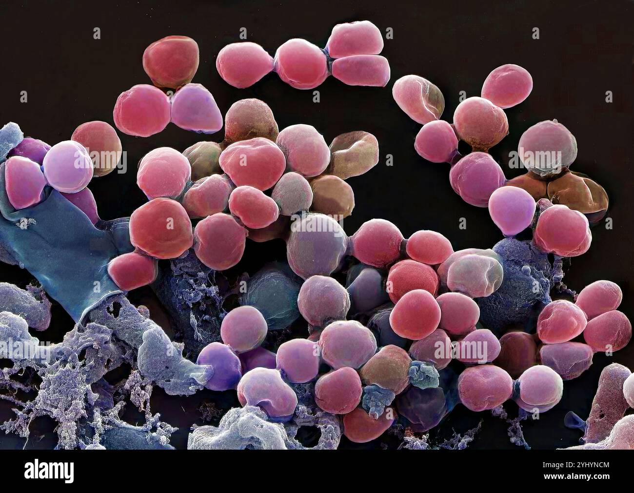 Chlamydia. Coloured scanning electron micrograph (SEM) of a colony of ...