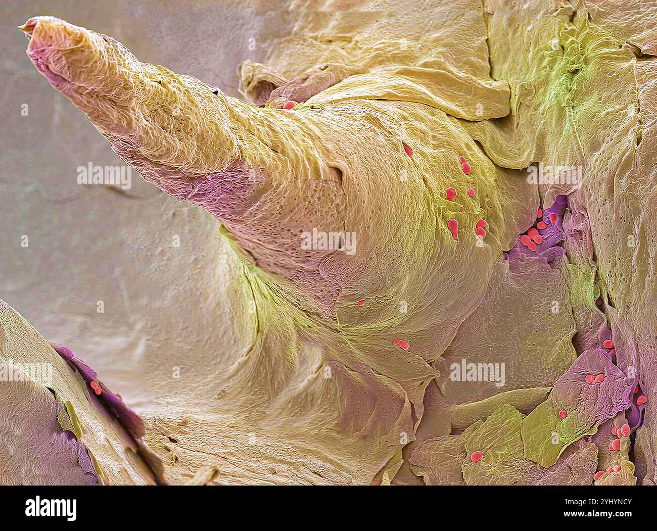 Skin tape sample. Coloured scanning electron micrograph (SEM) of a skin ...