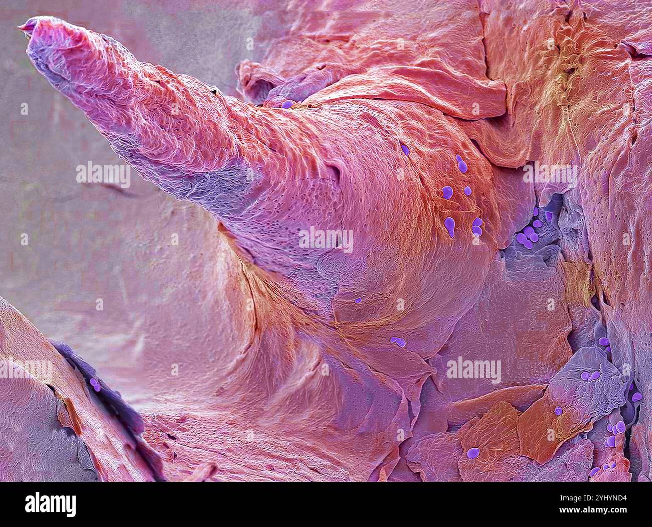 Skin tape sample. Coloured scanning electron micrograph (SEM) of a skin ...