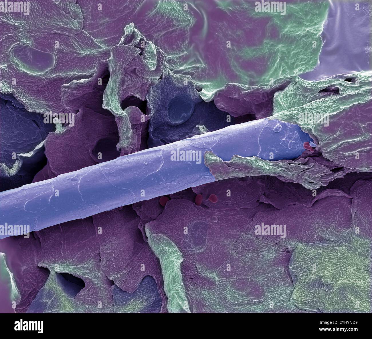 Skin tape sample. Coloured scanning electron micrograph (SEM) of a skin ...