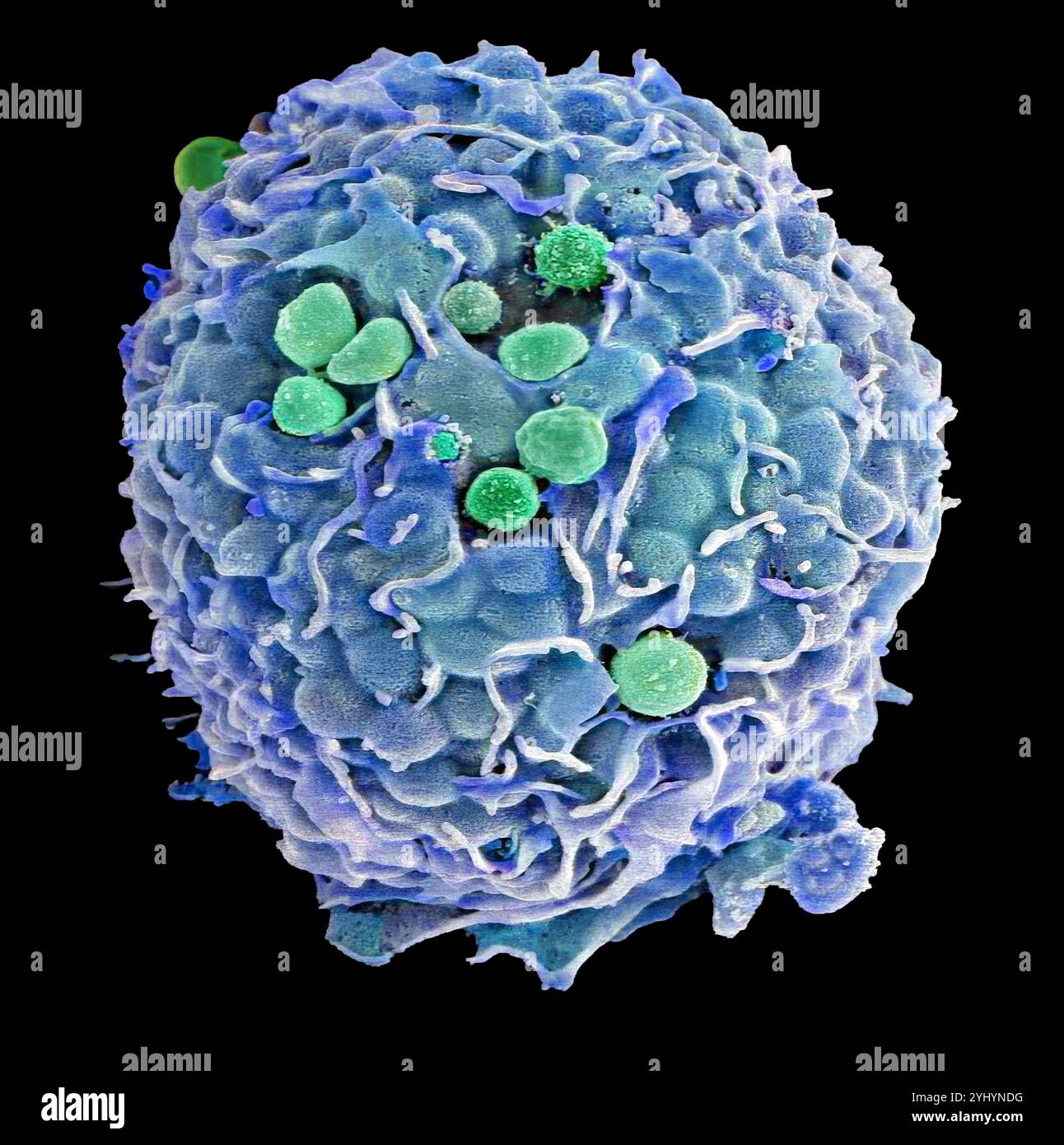 Activated mast cell, SEM Stock Photo - Alamy