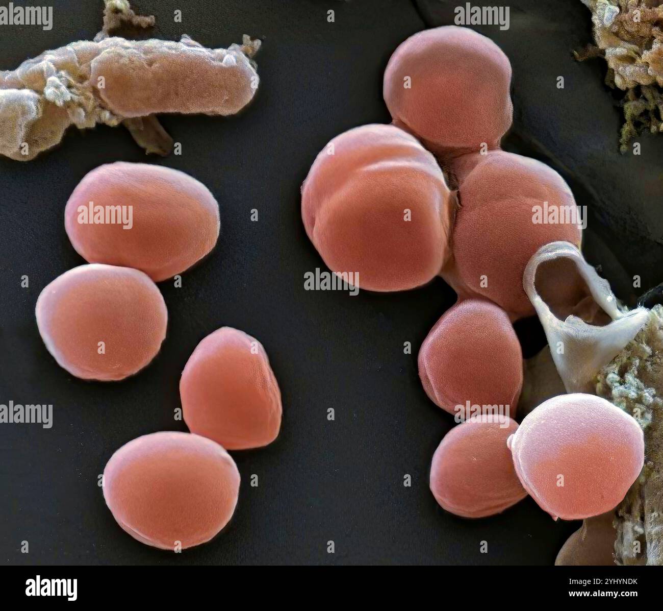 Chlamydia. Coloured scanning electron micrograph (SEM) of a colony of ... Chlamydia. Coloured scanning electron micrograph (SEM) of a colony of ...