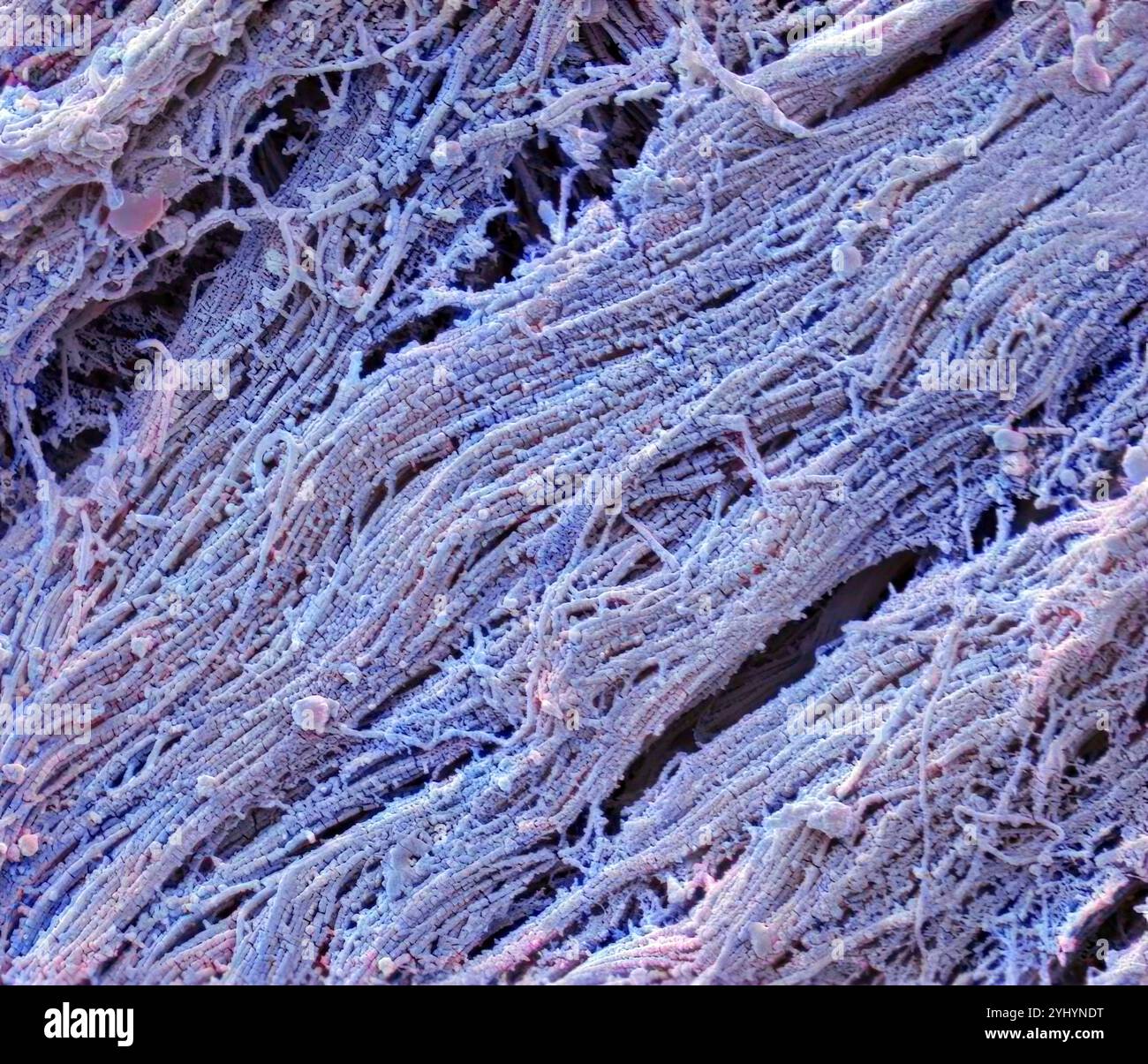 Periodontal ligament. Coloured scanning electron micrograph (SEM) of ...