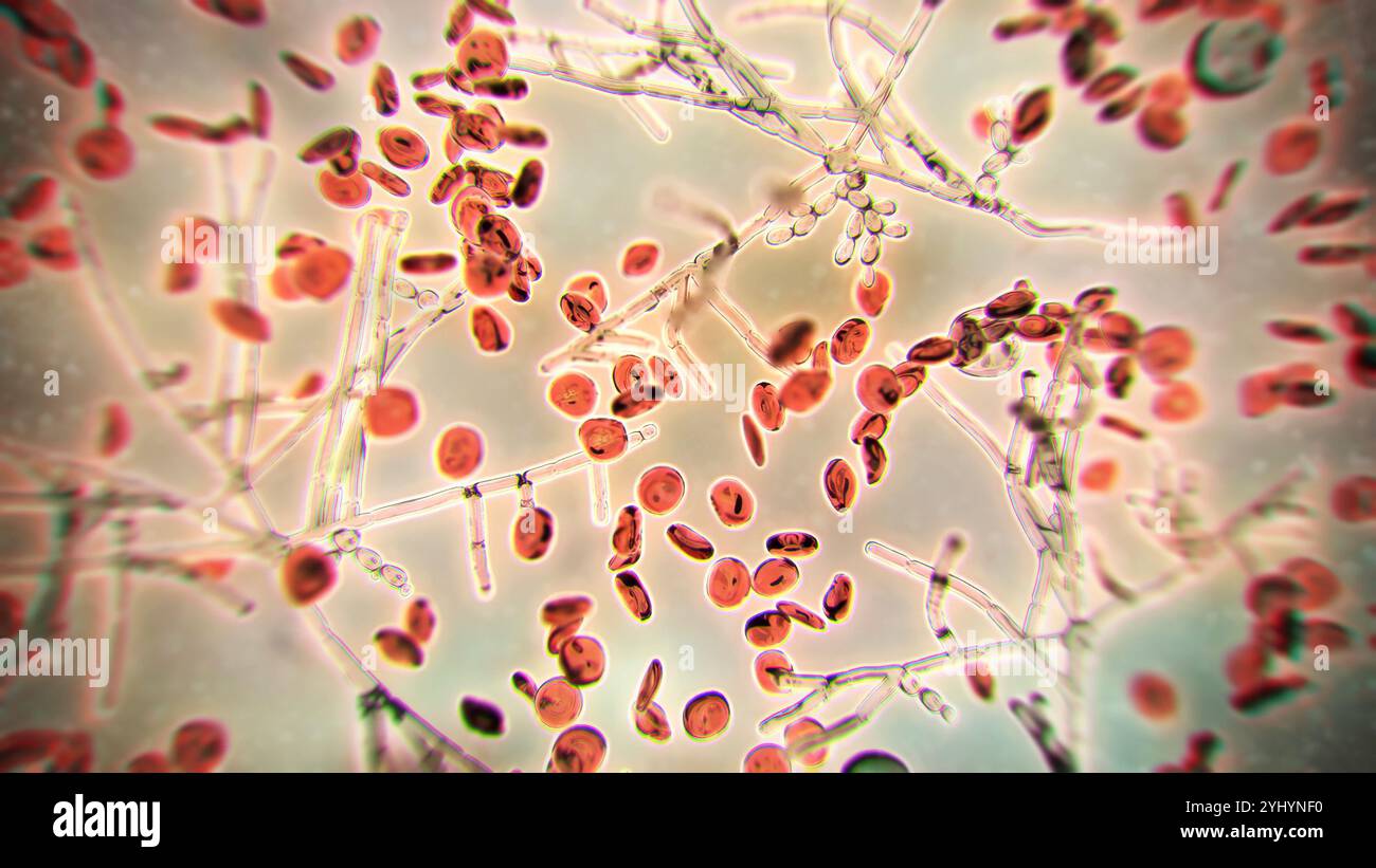 Illustration of a Candida auris fungus (filaments) infection of the ...