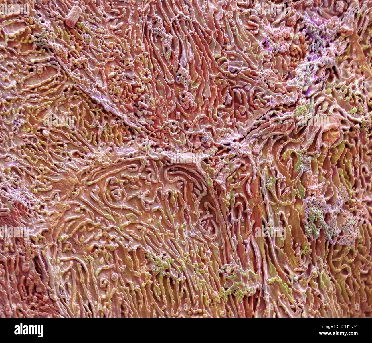 Gingiva. Coloured scanning electron micrograph (SEM) of keratinised ...