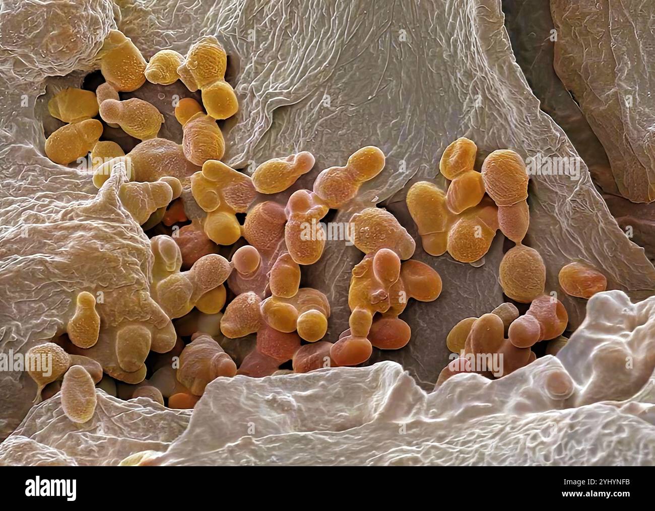 Acne bacteria. Coloured scanning electron micrograph (SEM) of a skin ...