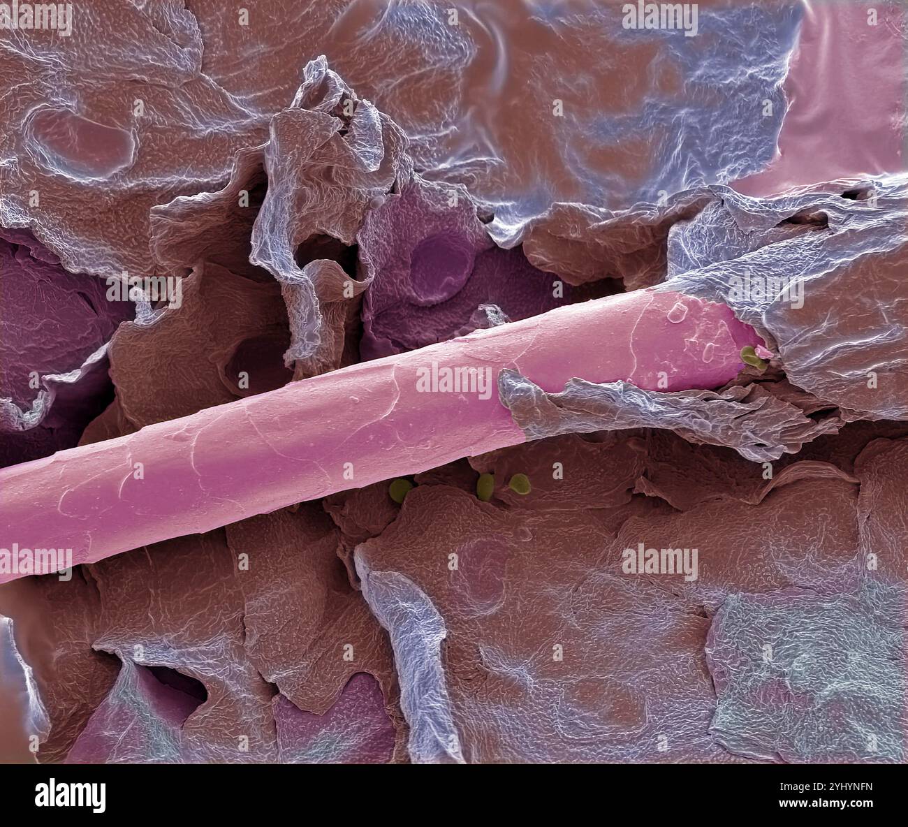 Skin tape sample. Coloured scanning electron micrograph (SEM) of a skin ...