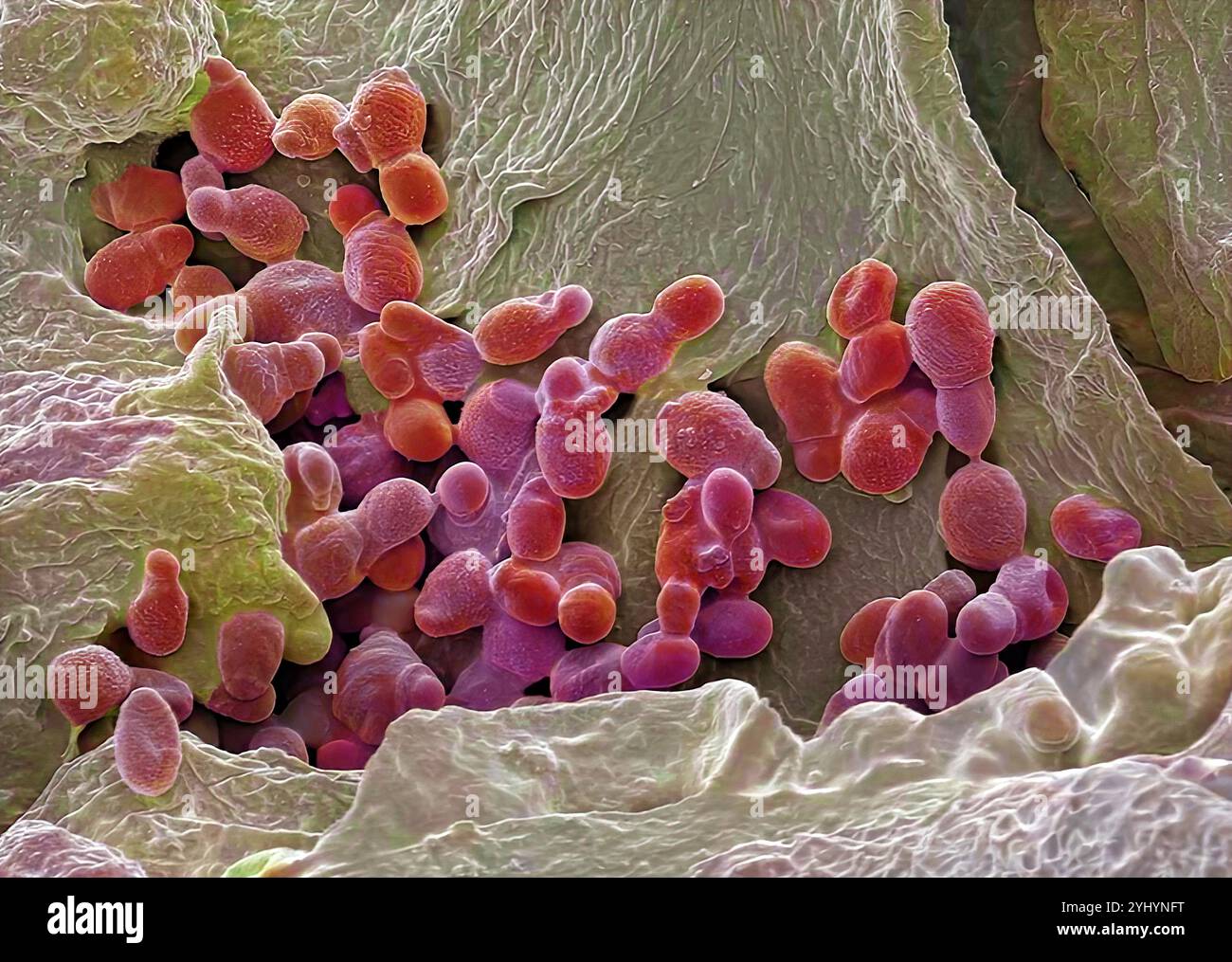 Acne bacteria. Coloured scanning electron micrograph (SEM) of a skin ...