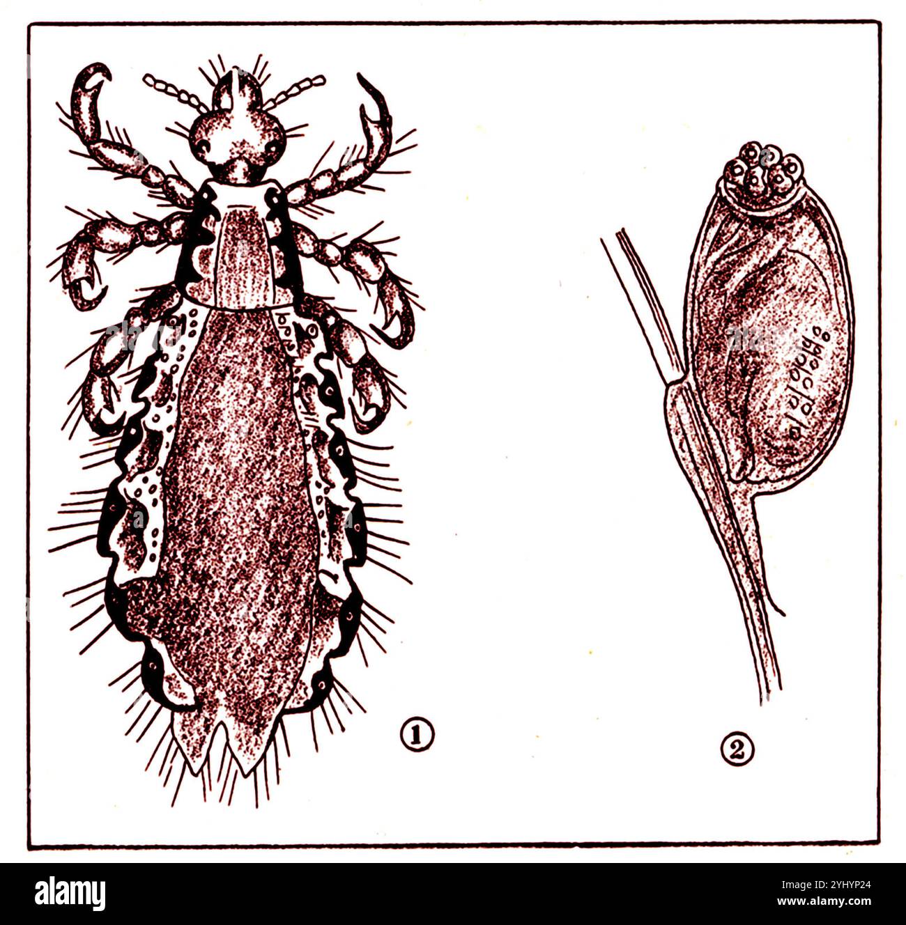 Illustration of a female head louse (Pediculus humanus capitis, left ...