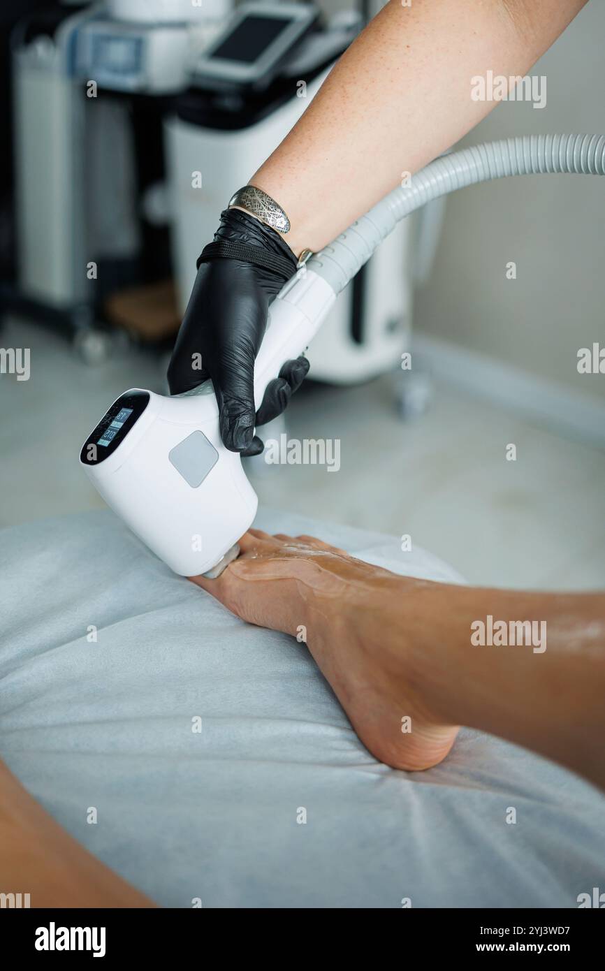 Modern apparatus for laser epilation of the body. Hair removal device ...