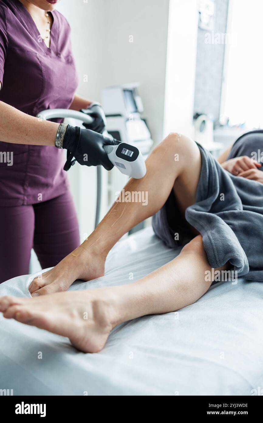 Modern apparatus for laser epilation of the body. Hair removal device ...