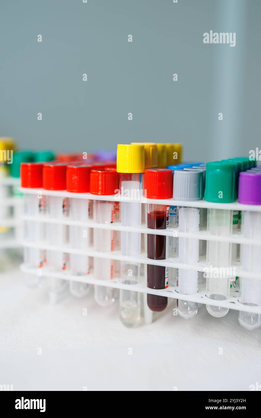 Test tubes with blood. Taking blood from a vein for research Stock ...