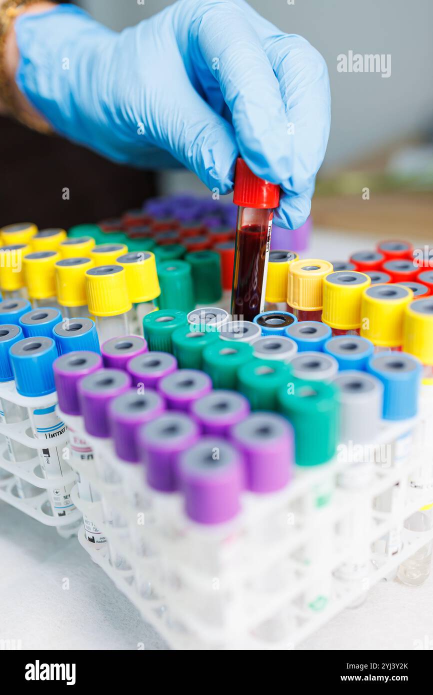 Test tubes with blood. Taking blood from a vein for research Stock ...