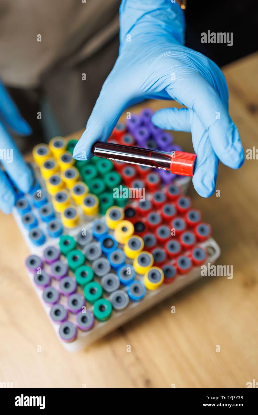 Test tubes with blood. Taking blood from a vein for research Stock ...