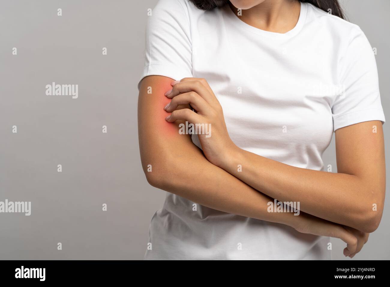 Red arm of person with allergic reaction, scratching itching skin ...