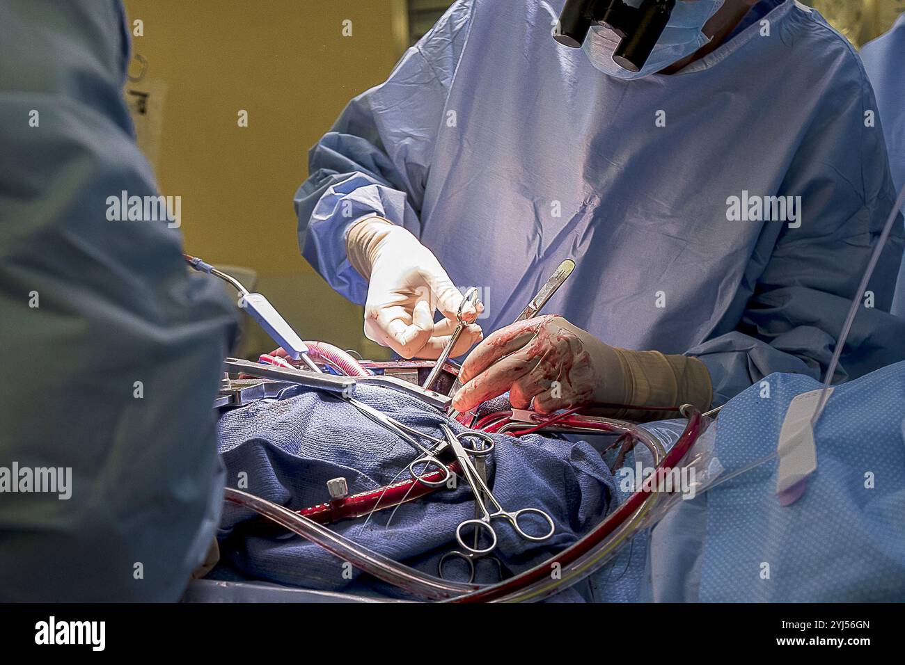 A skilled surgeon is performing a complex operation in a sterile ...