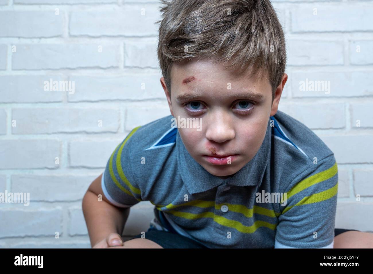 Young boy with bruises and cuts on his face looking sad and upset Stock ...