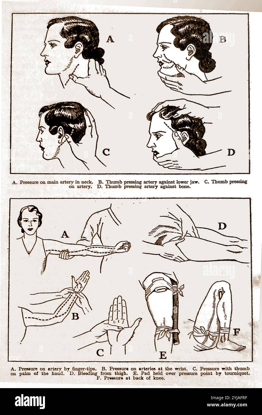 Neck arteries hi-res stock photography and images - Alamy