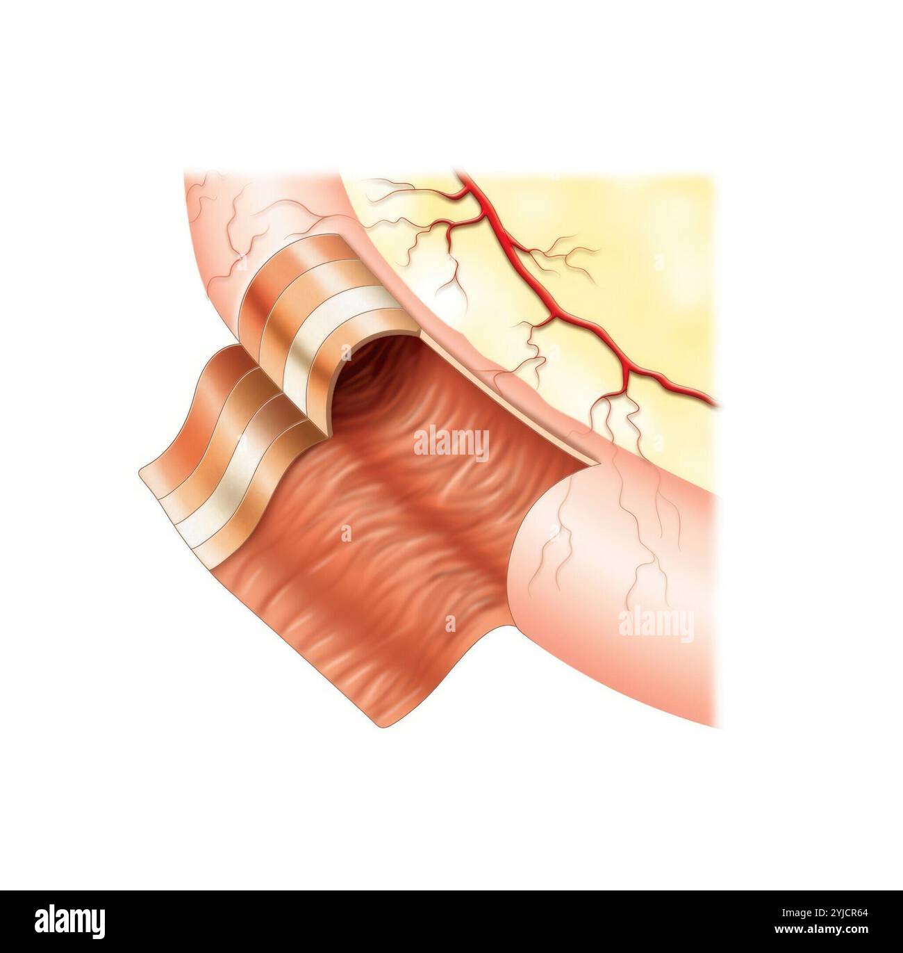 Jejunum hi-res stock photography and images - Alamy