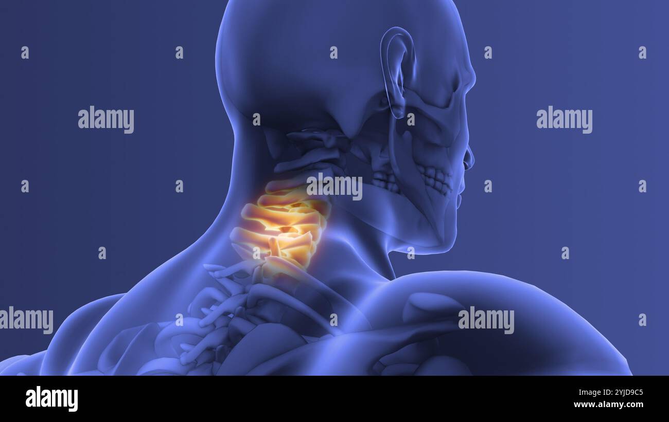 Cervical spine skeletal anatomy causing neck pain Stock Photo - Alamy