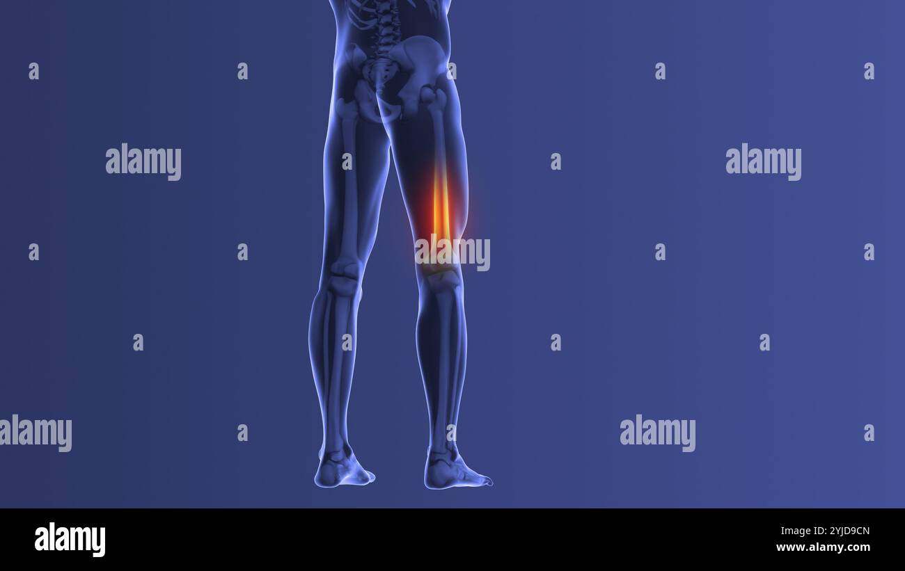 Low Back & Radiating Leg Pain anatomy Stock Photo - Alamy