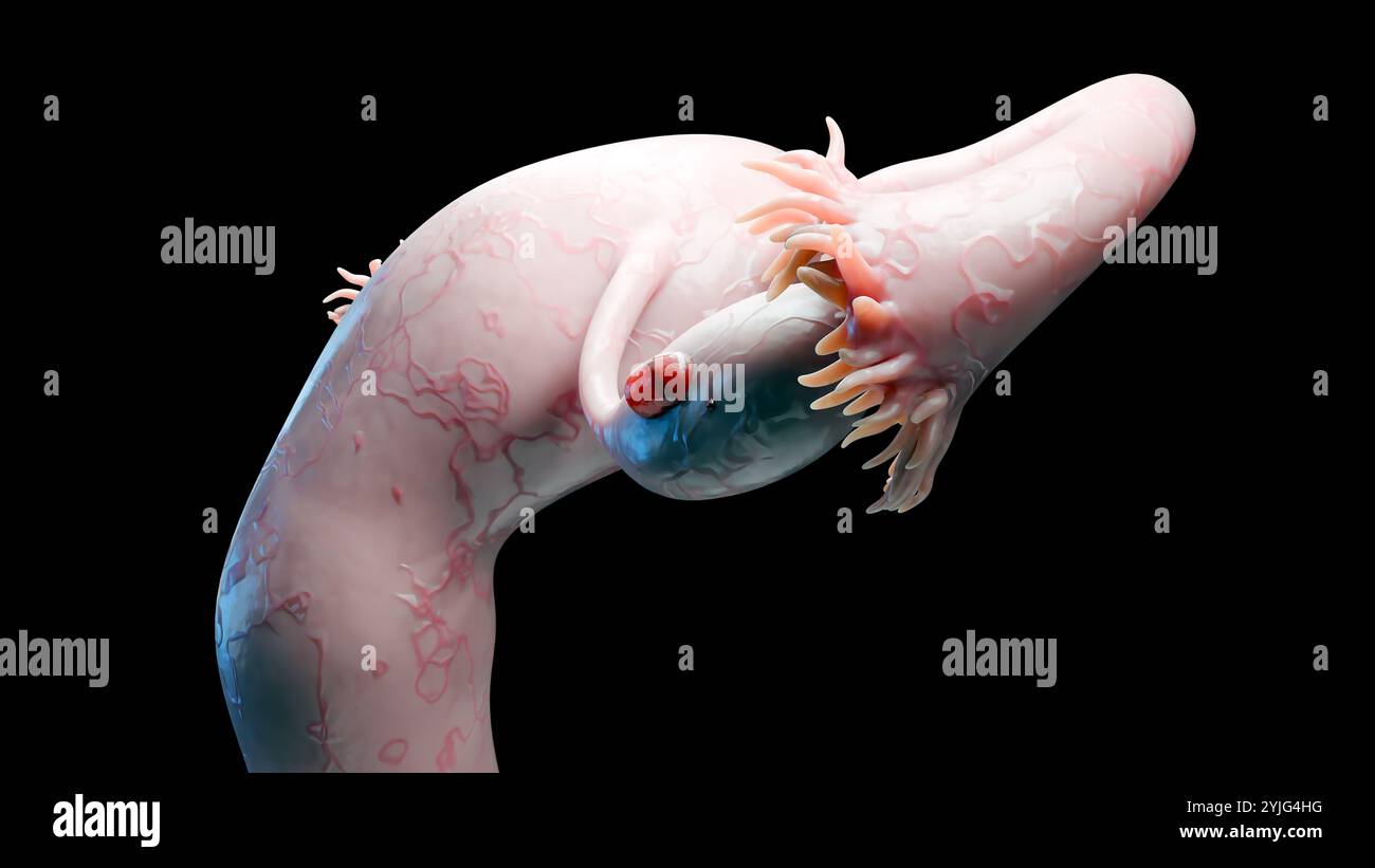 Ovarian malignant tumor, Female uterus anatomy, Reproductive system ...