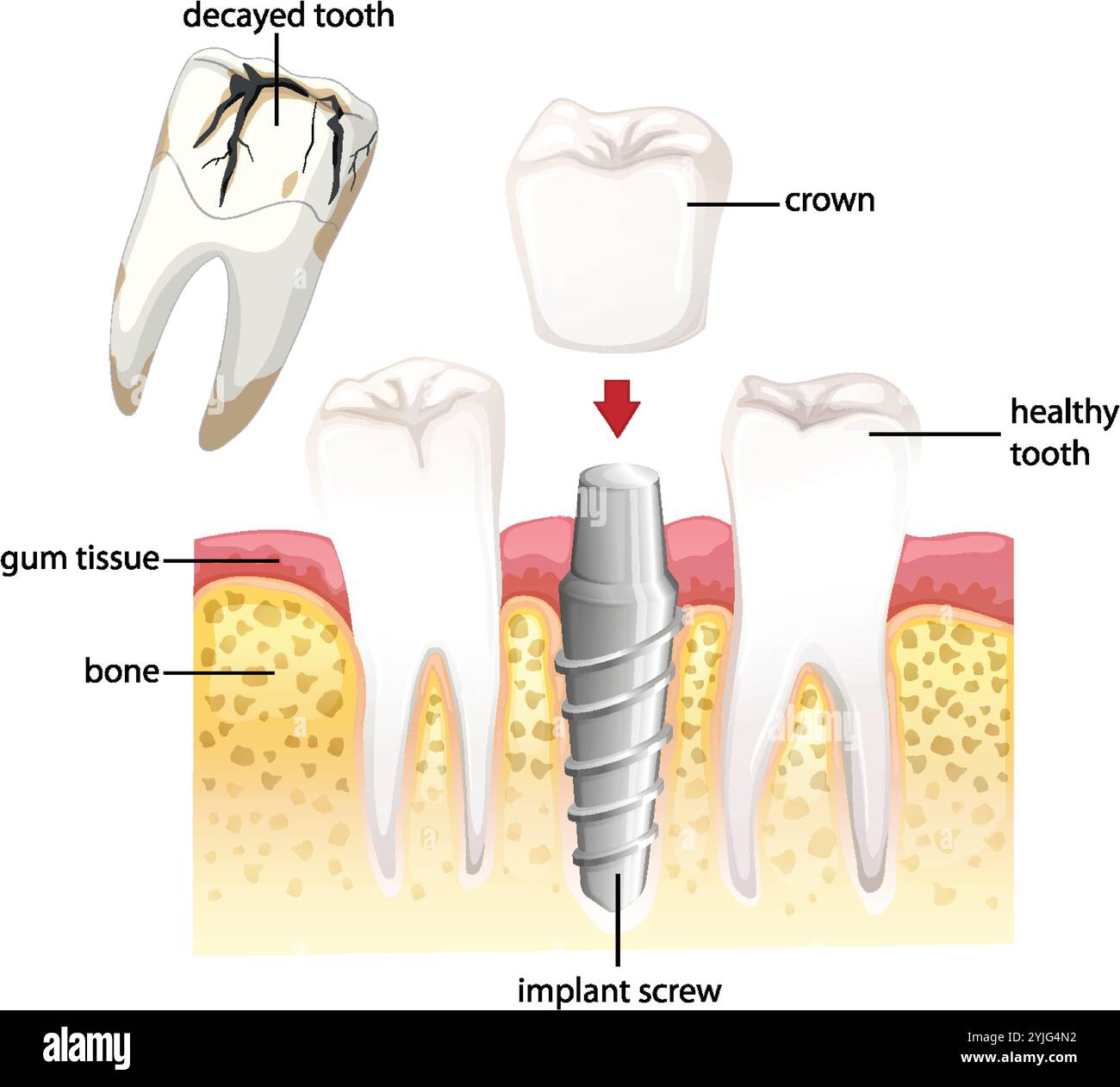 Parts tooth diagram illustration Cut Out Stock Images & Pictures - Alamy