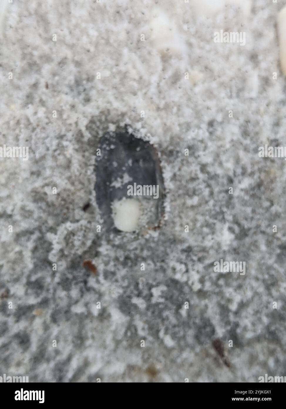 Cardites hi-res stock photography and images - Alamy