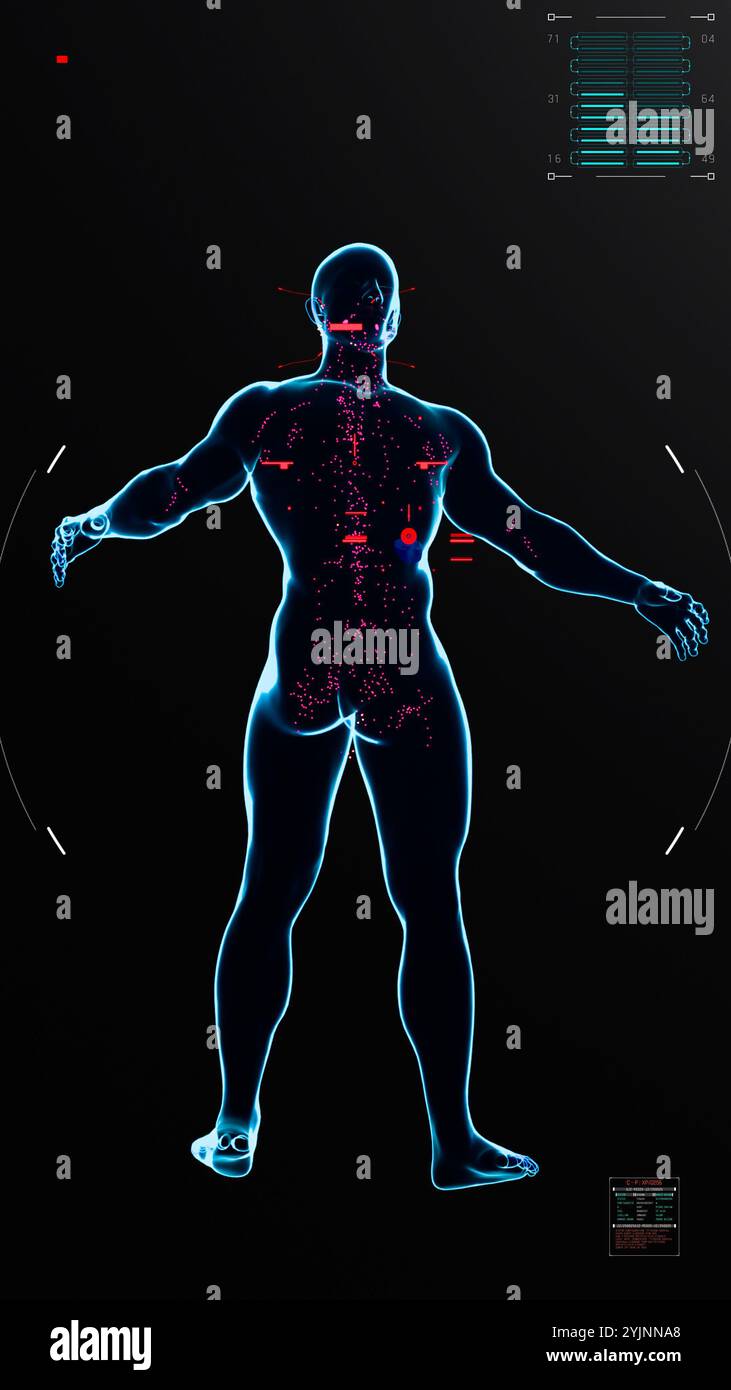 Non-Hodgkin lymphoma holographic AI non Hodgkin's lymphoma treatments ...