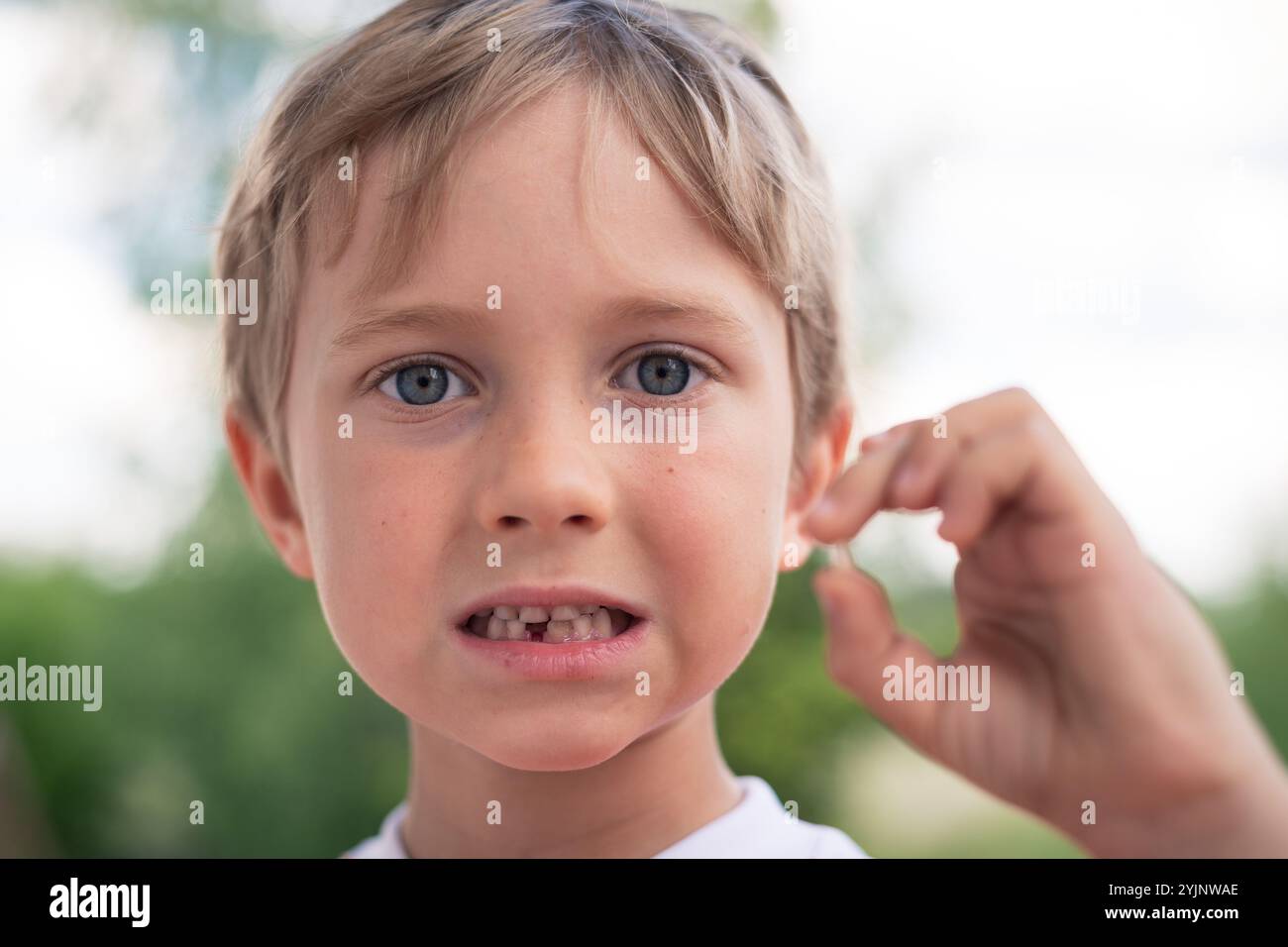 6 years old boy shows the ruptured milk tooth Stock Photo - Alamy