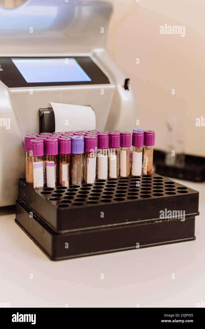 Blood sample tubes in a laboratory analyzer for testing and diagnostics ...