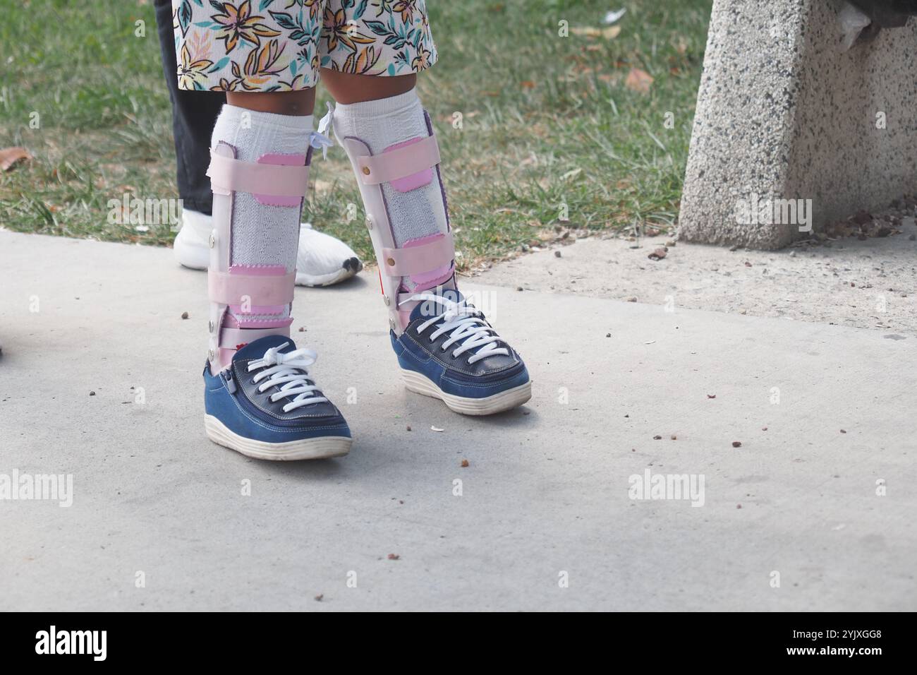 Child cerebral palsy disability, legs orthosis Stock Photo - Alamy
