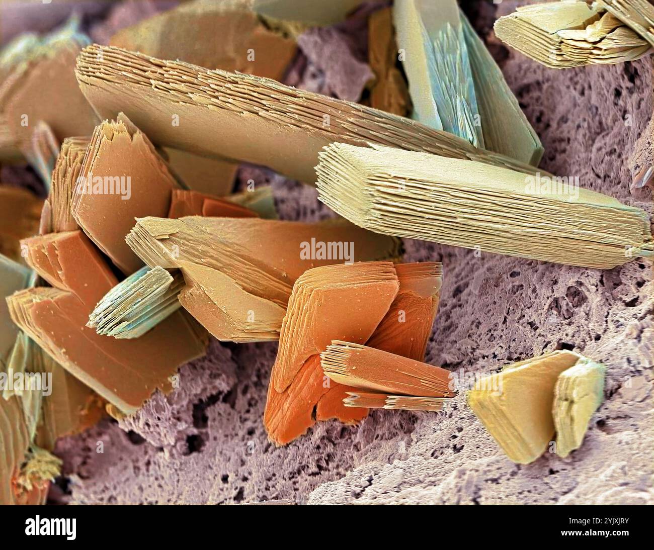 Albumin crystals hi-res stock photography and images - Alamy
