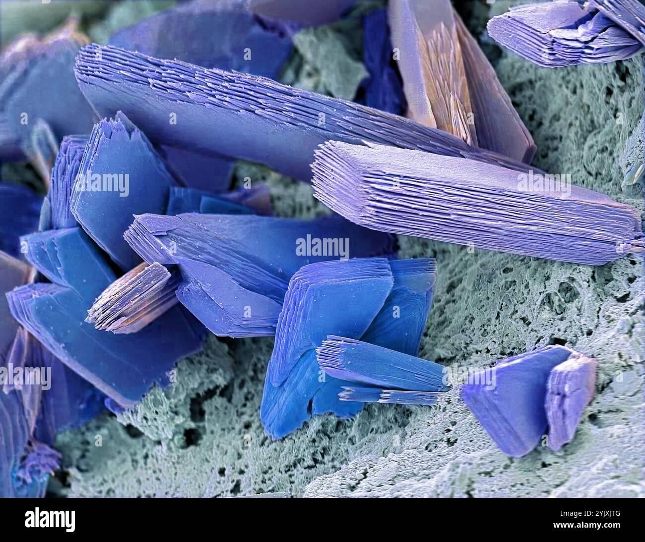 Albumin crystals hi-res stock photography and images - Alamy